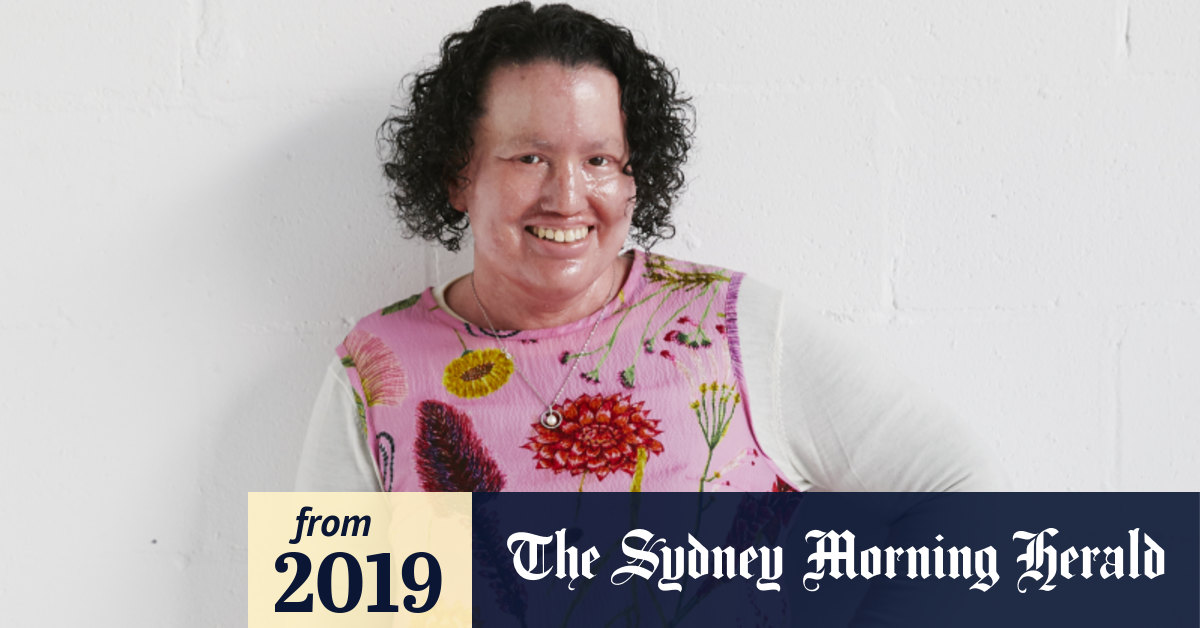 Dicey Topics Carly Findlay Talks Money Sex And Politics